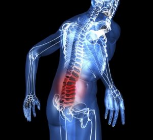 Lumbalgia laboral o lumbalgia en el trabajo - GEOMEDICA